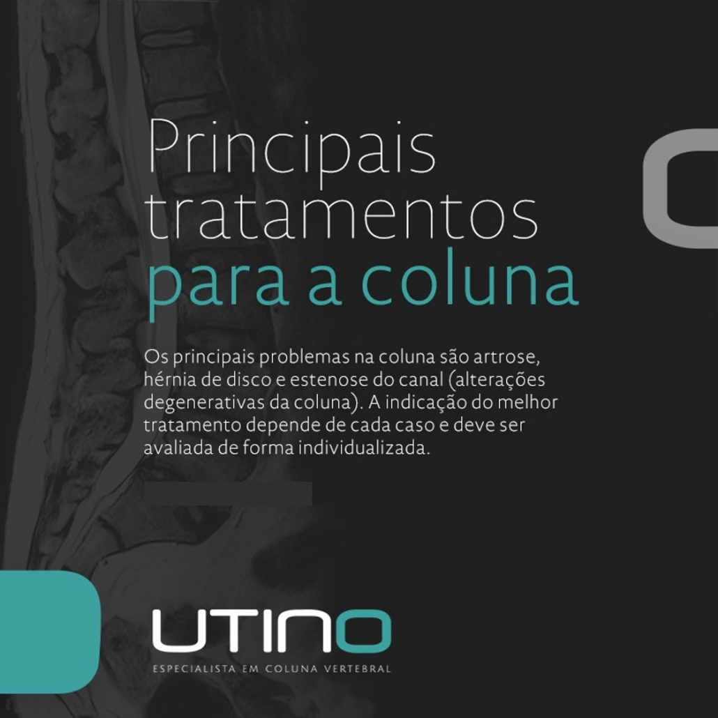 Principais Tratamentos para Problemas na Coluna - Dr. Edgar Utino