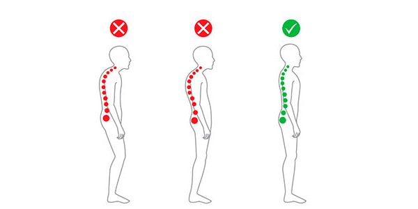Postura correta: as melhores dicas para uma postura correta