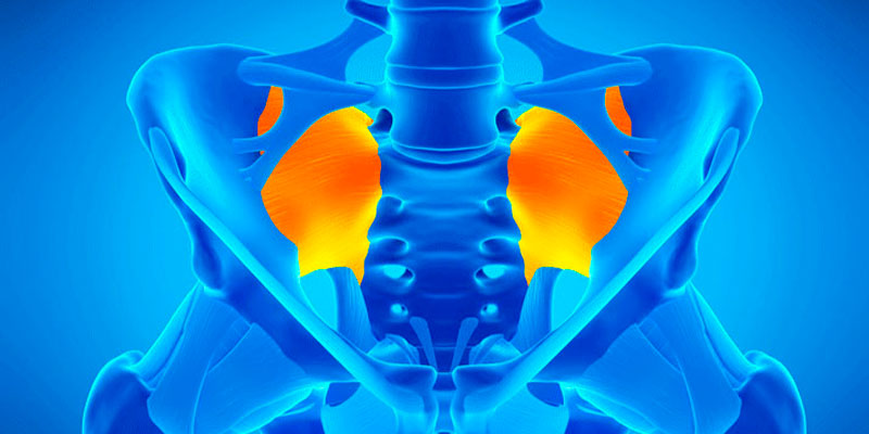 Sacroileíte: O que é a inflamação da articulação sacroilíaca