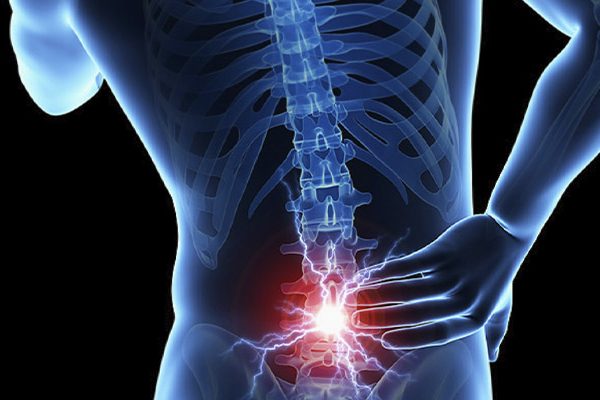 Alterações na Coluna - As Principais alterações da coluna vertebral