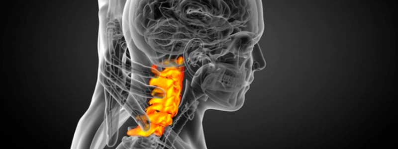 Estenose cervical: causas, diagnóstico e tratamento - Dr. Edgar Utino