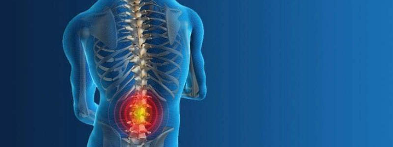 Lesões de Modic: conheça mais os tipos, causas e tratamento - Dr. Edgar ...