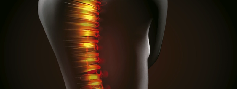 Retificação da lordose lombar: o que é, diagnóstico e tratamento - Dr ...